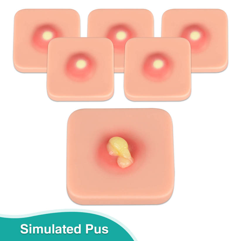 Ultrassist Abscess I&D Incision and Drainage Trainer (6-Pack Pad)