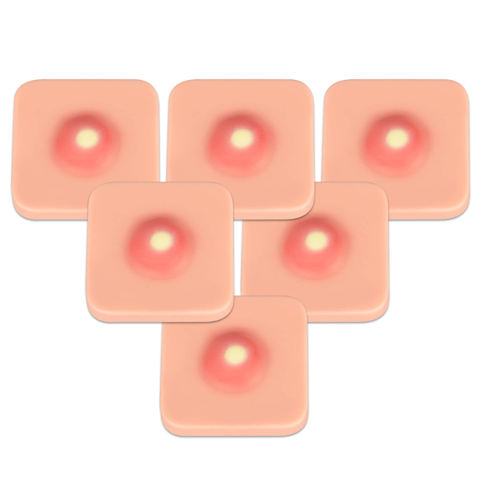 Ultrassist Abscess I&D Incision and Drainage Trainer (6-Pack Pad)