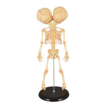 Infant Fetus Skeleton Model with Double Skull Head – Ultrassist