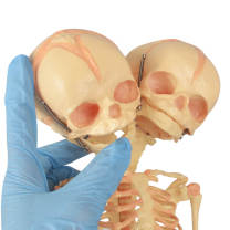 Infant Fetus Skeleton Model with Double Skull Head – Ultrassist