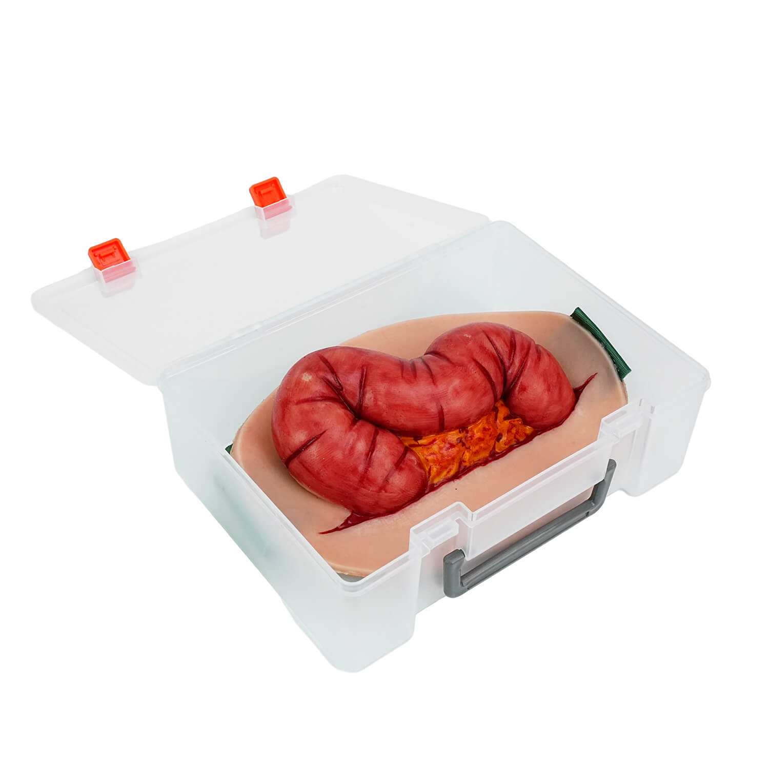 Wearable Abdominal Eviscerated Large Intestine Wound Simulator – Ultrassist
