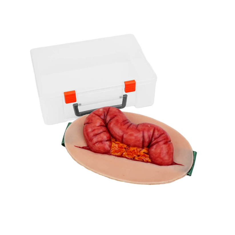 Wearable Abdominal Eviscerated Large Intestine Wound Simulator – Ultrassist
