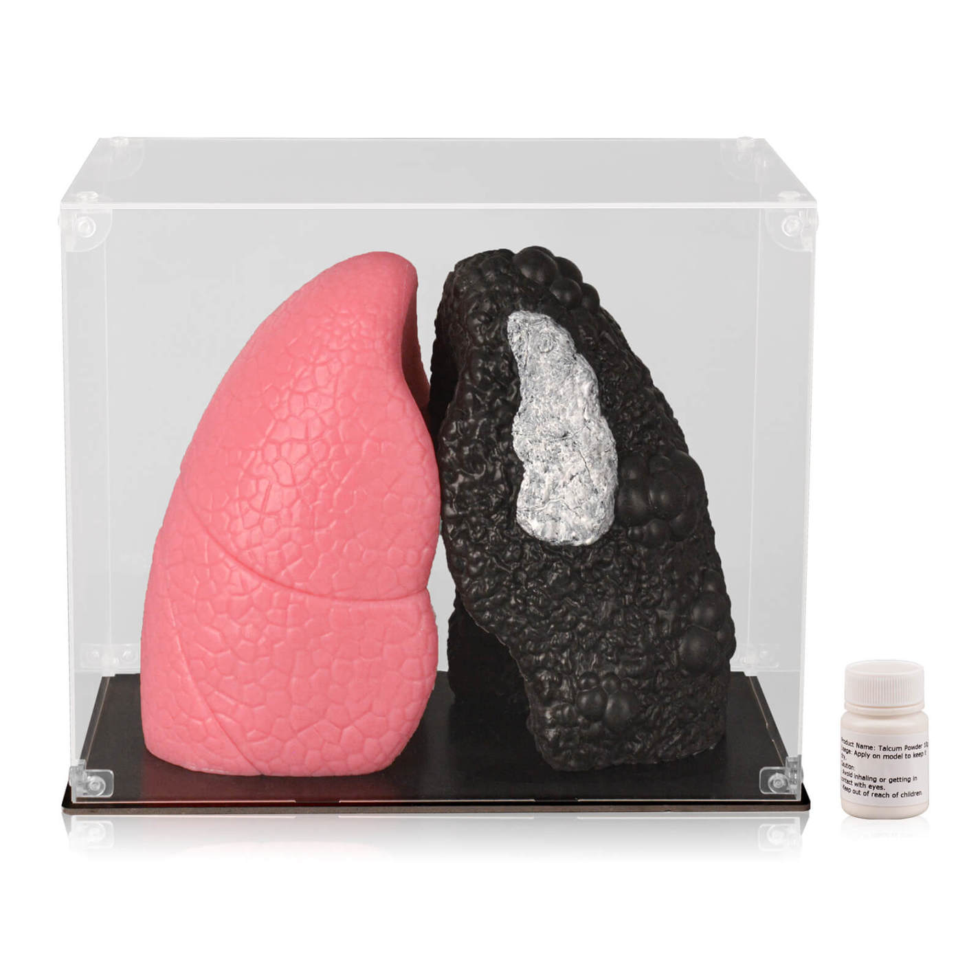 Ultrassist Healthy Lung vs. Smokers Lung Model Set