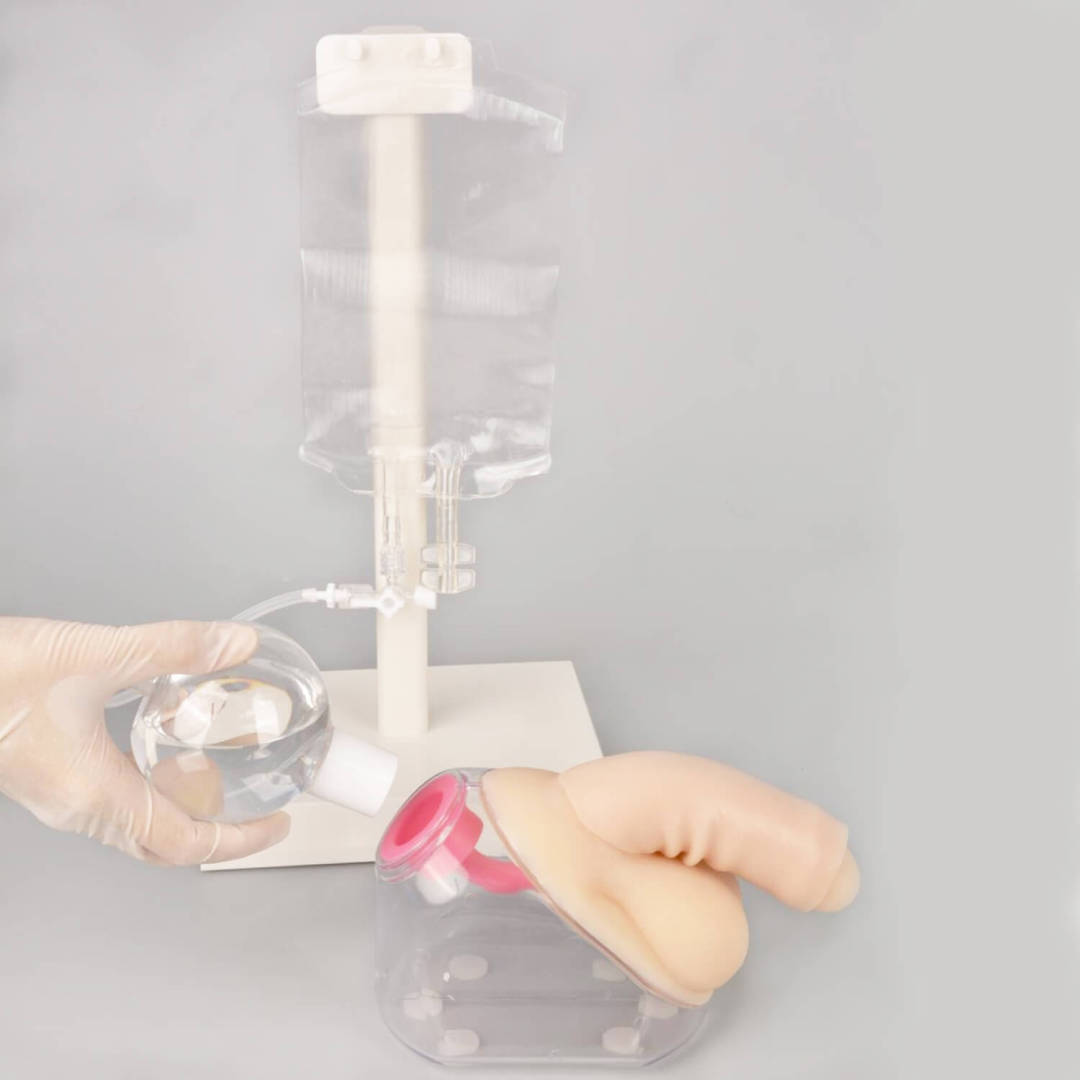 How to Check Dilation with Fingers: A Practical Measurement Guide ...