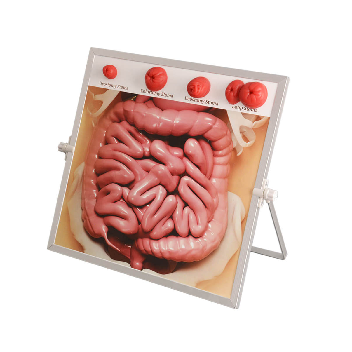 Ostomy Care Teaching Kit with Magnetic Stoma Models – Ultrassist