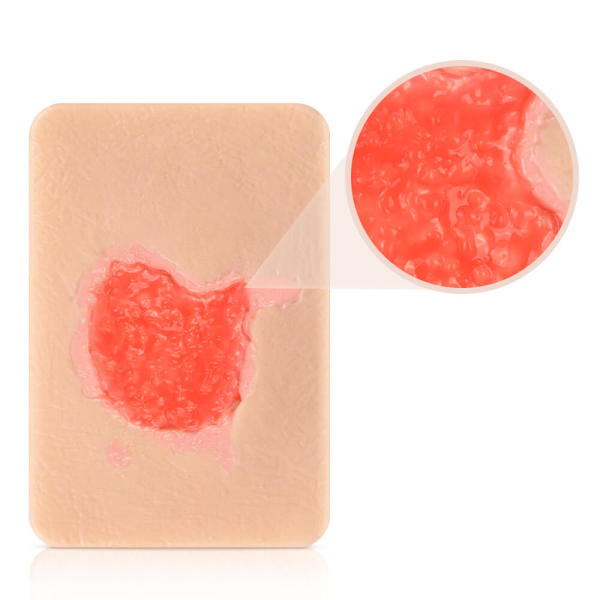 Ultrassist Granulation Tissue Wound Simulation Models (4 pcs)
