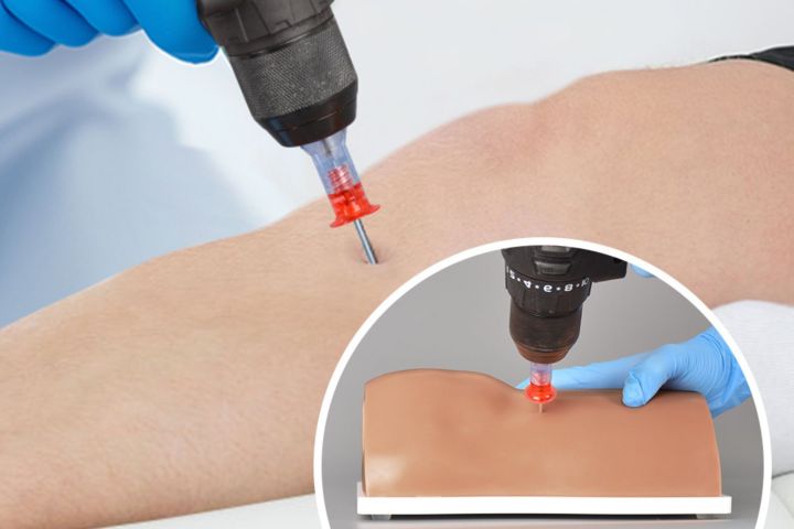 Preferred Sites for Intraosseous Access, Injection, Needle Insertion ...