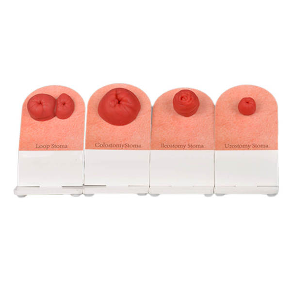 Ostomy Care Training Kit with 4 Stoma Models on Stands – Ultrassist