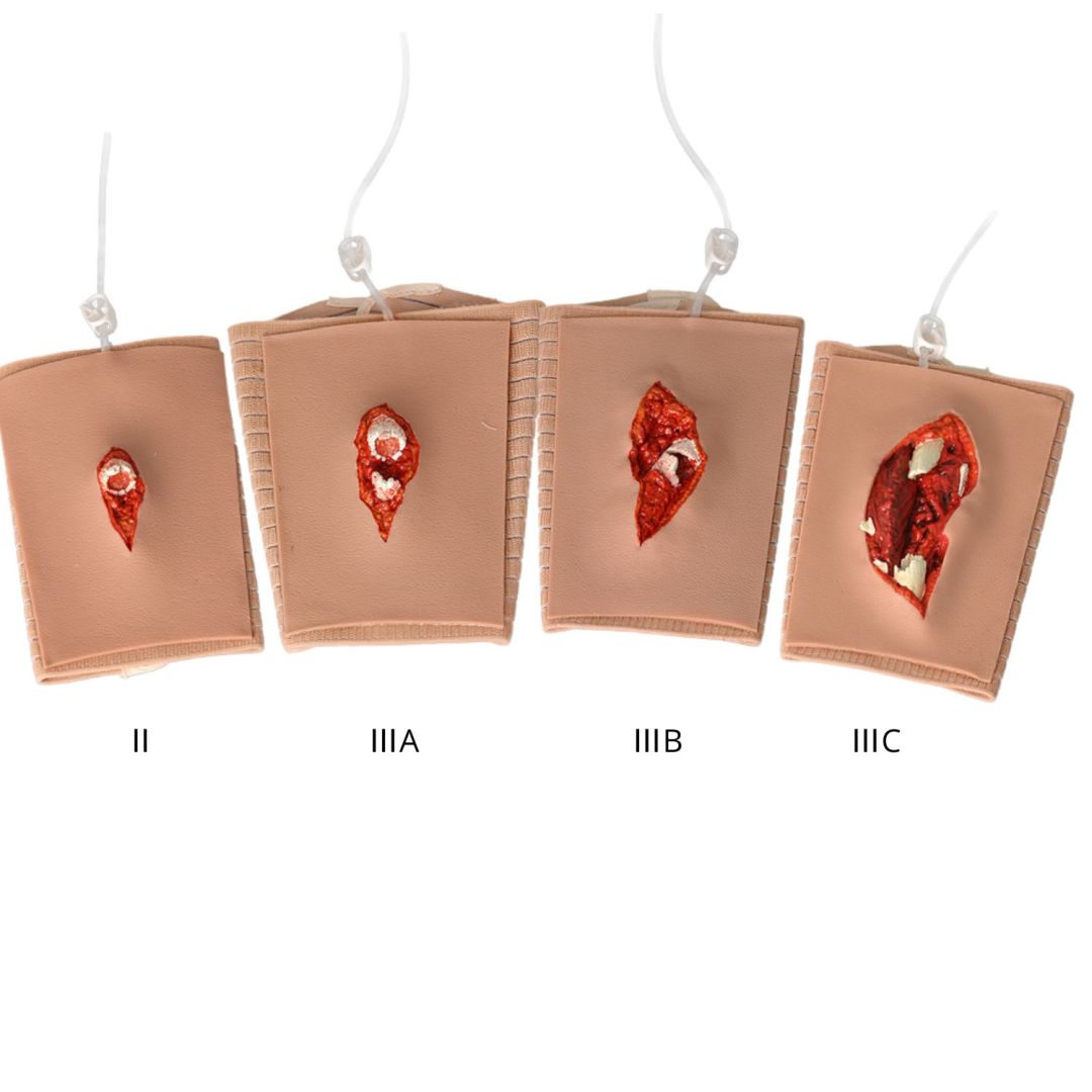 How to Measure and Use OPA and NPA in Airway Management – Ultrassist