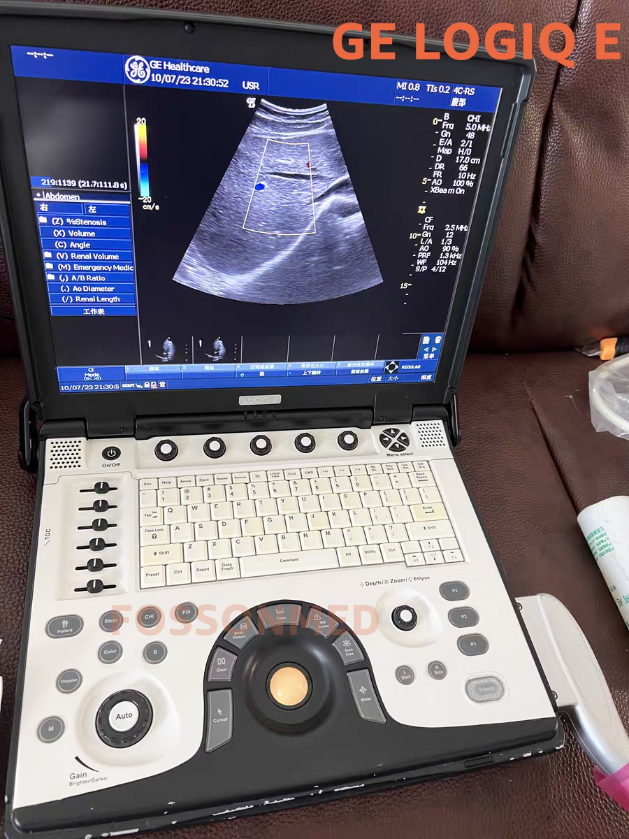 Ultrasound Systems – FOSSONMED