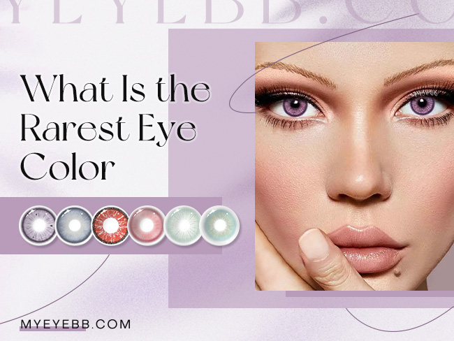 What Is the Rarest Eye Color
