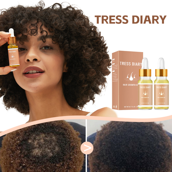 TressDiary®️ HAIR GROWTH OIL