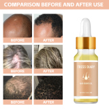 TressDiary®️ HAIR GROWTH OIL