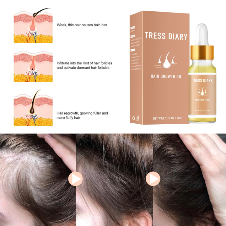 TressDiary®️ HAIR GROWTH OIL