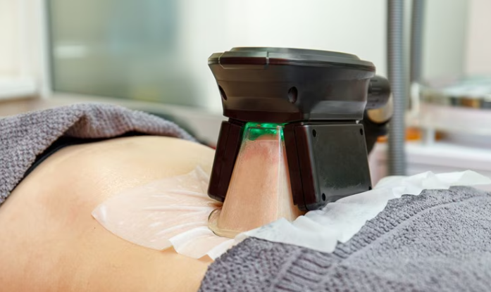 The Unique Effects of Freezing Fat: A Breakthrough in Fat Dissolving ...