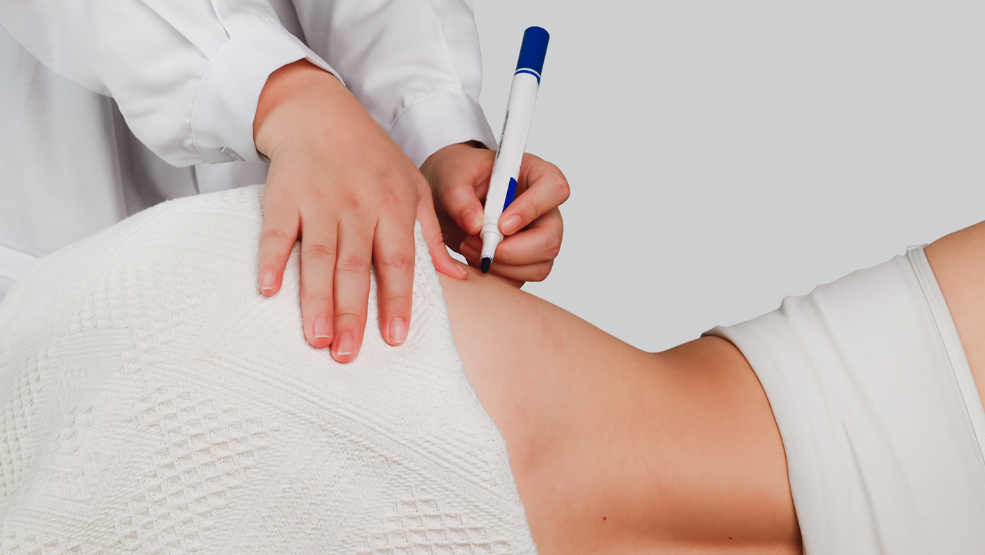 Greater Trochanteric Pain Syndrome – Pervita Medical