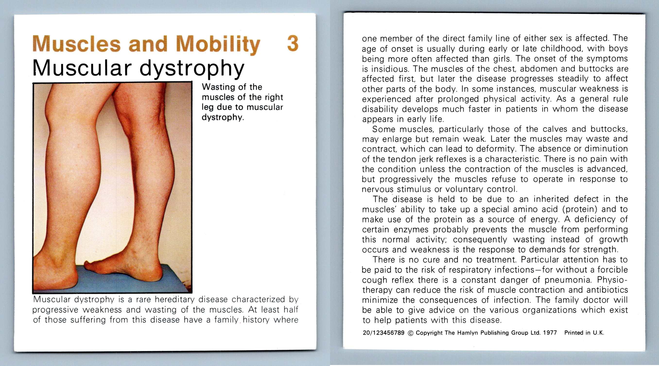Muscular Dystrophy #3 Muscles Home Medical Guide 1975-8 Hamlyn Card ...
