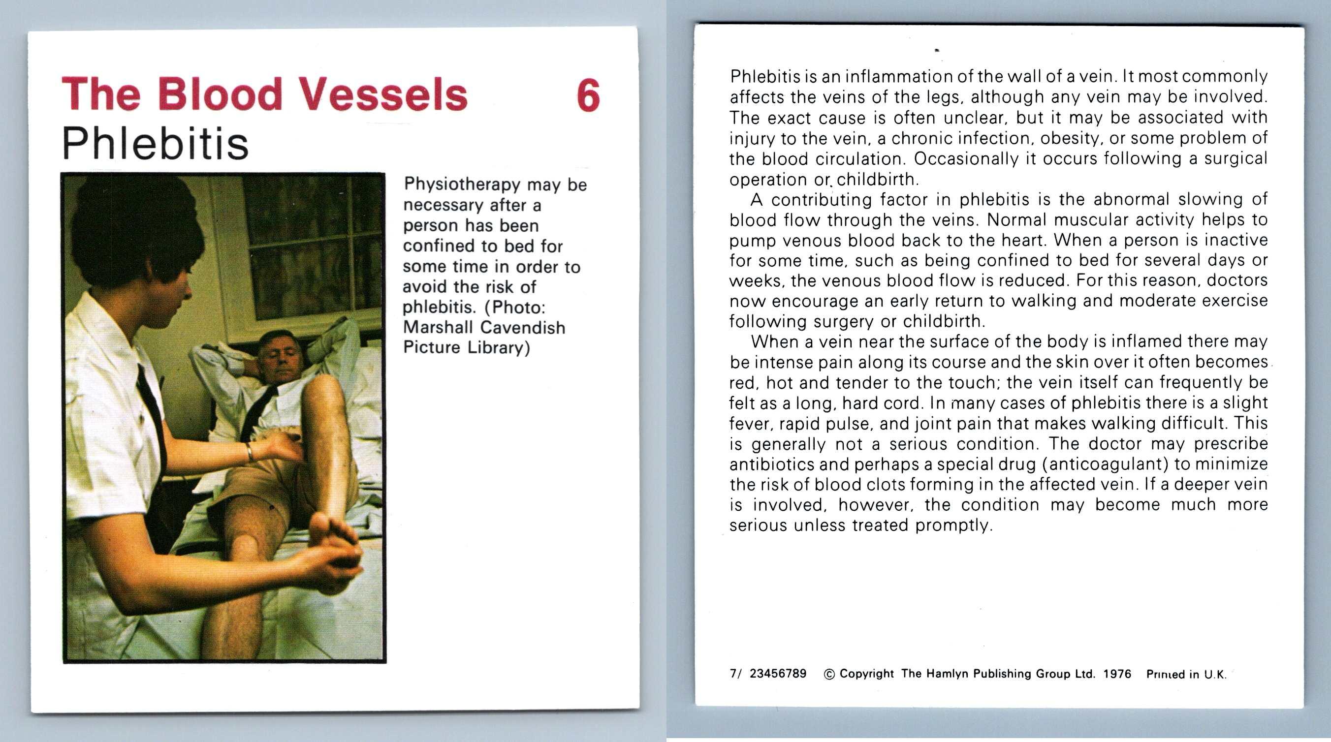 Phlebitis #6 Blood Vessels - Home Medical Guide 1975-8 Hamlyn Card ...