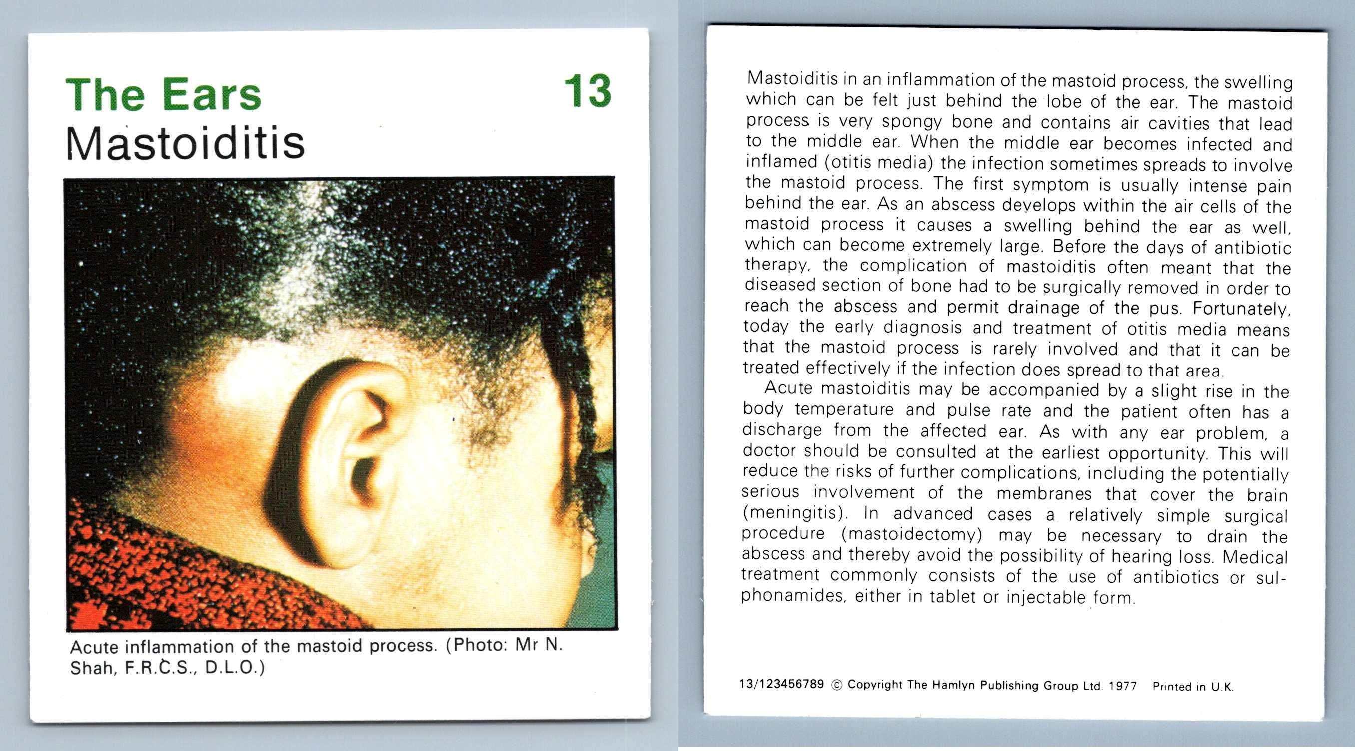 Mastoiditis #13 Ears - Home Medical Guide 1975-8 Hamlyn Card ...