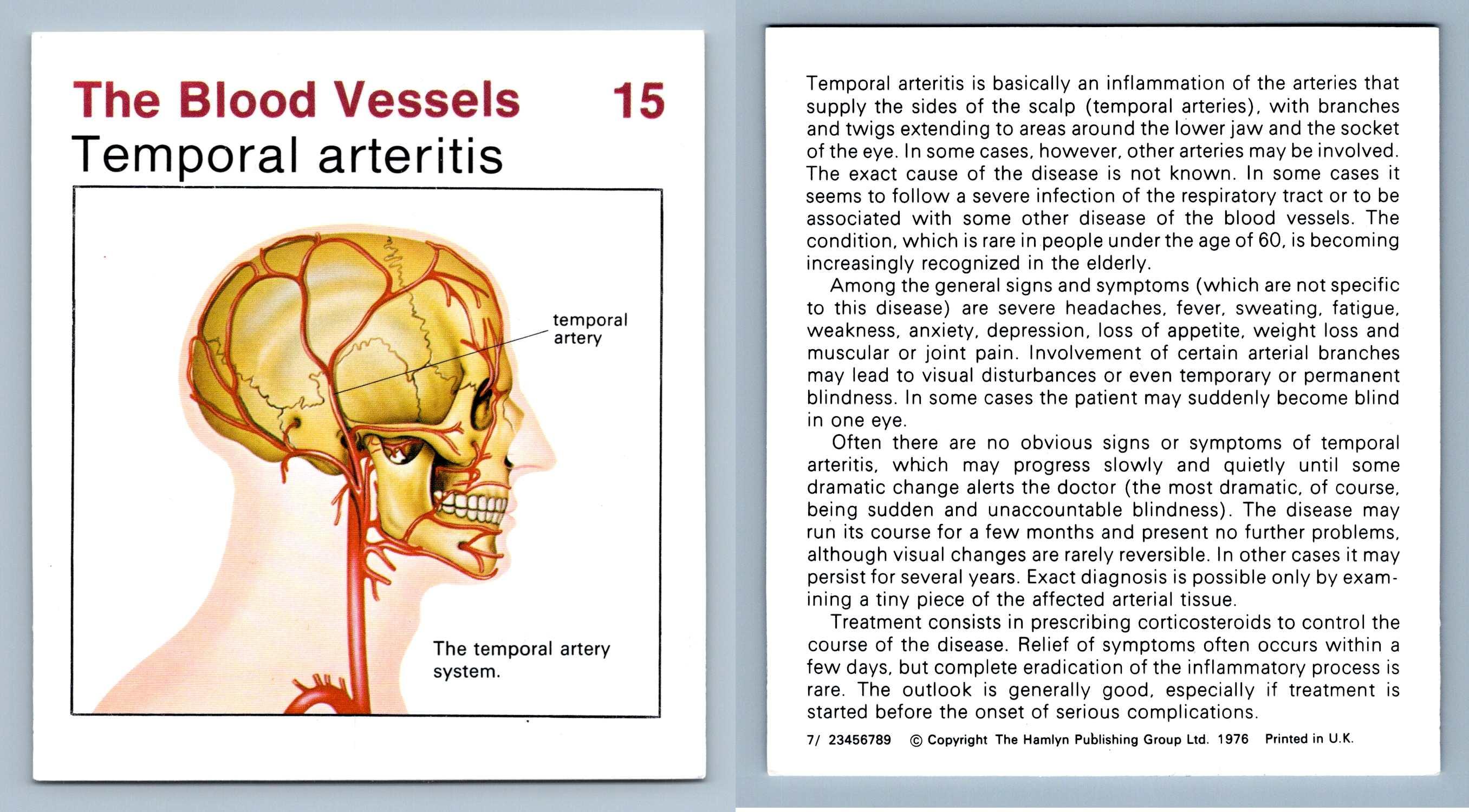 Temporal Arteritis #15 Blood Vessels - Home Medical Guide 1975-8 Hamly ...