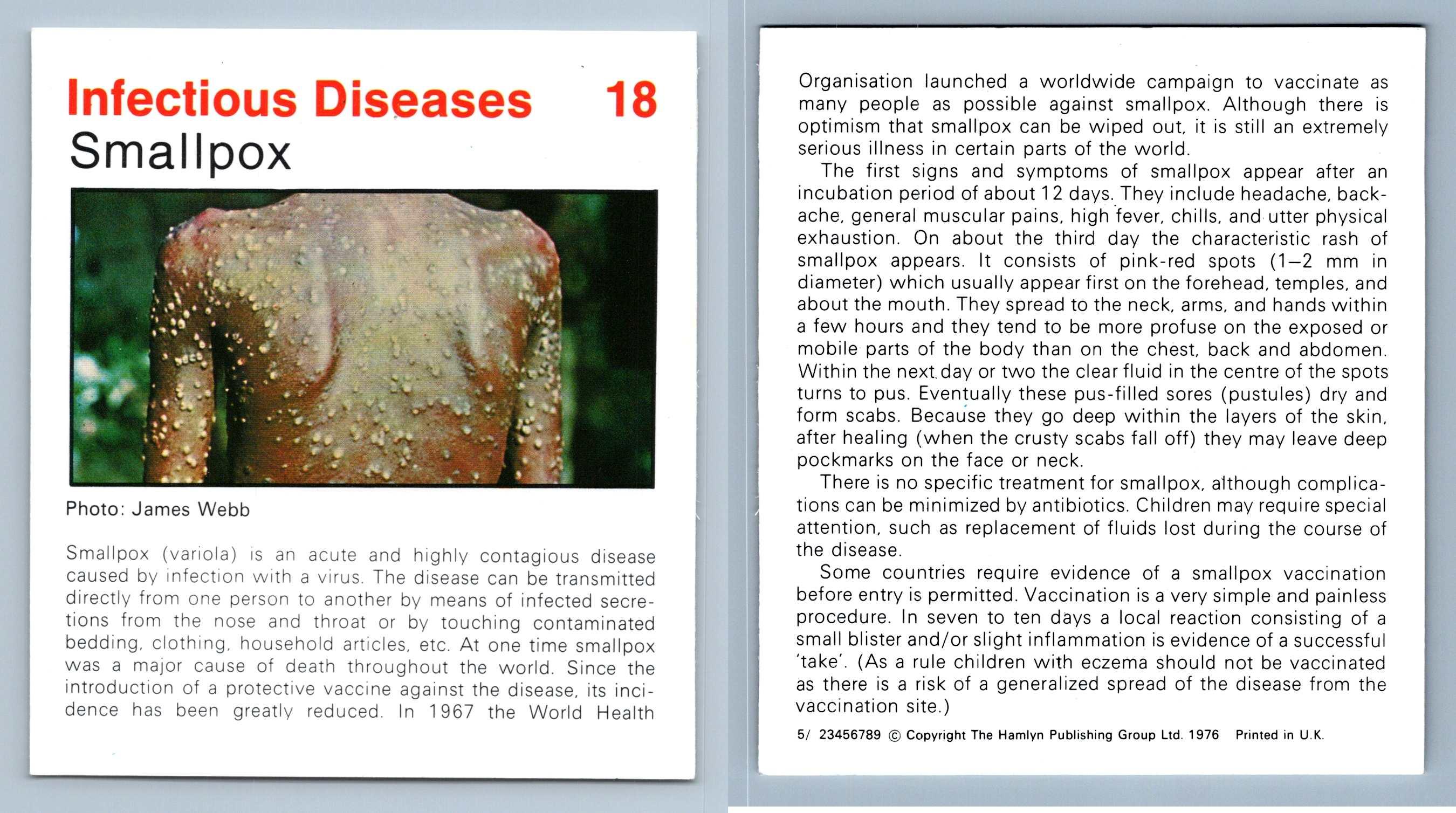 Smallpox #18 Infectious Home Medical Guide 1975-8 Hamlyn Card ...
