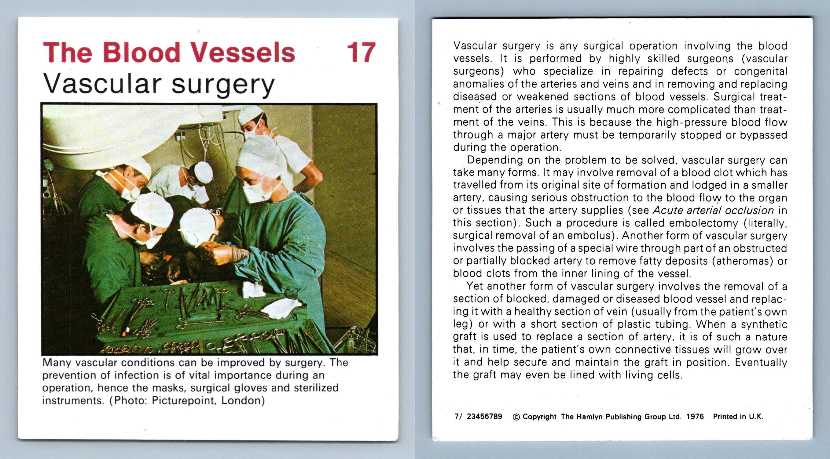 Vascular Surgery #17 Blood Vessels - Home Medical Guide 1975-8 Hamlyn ...