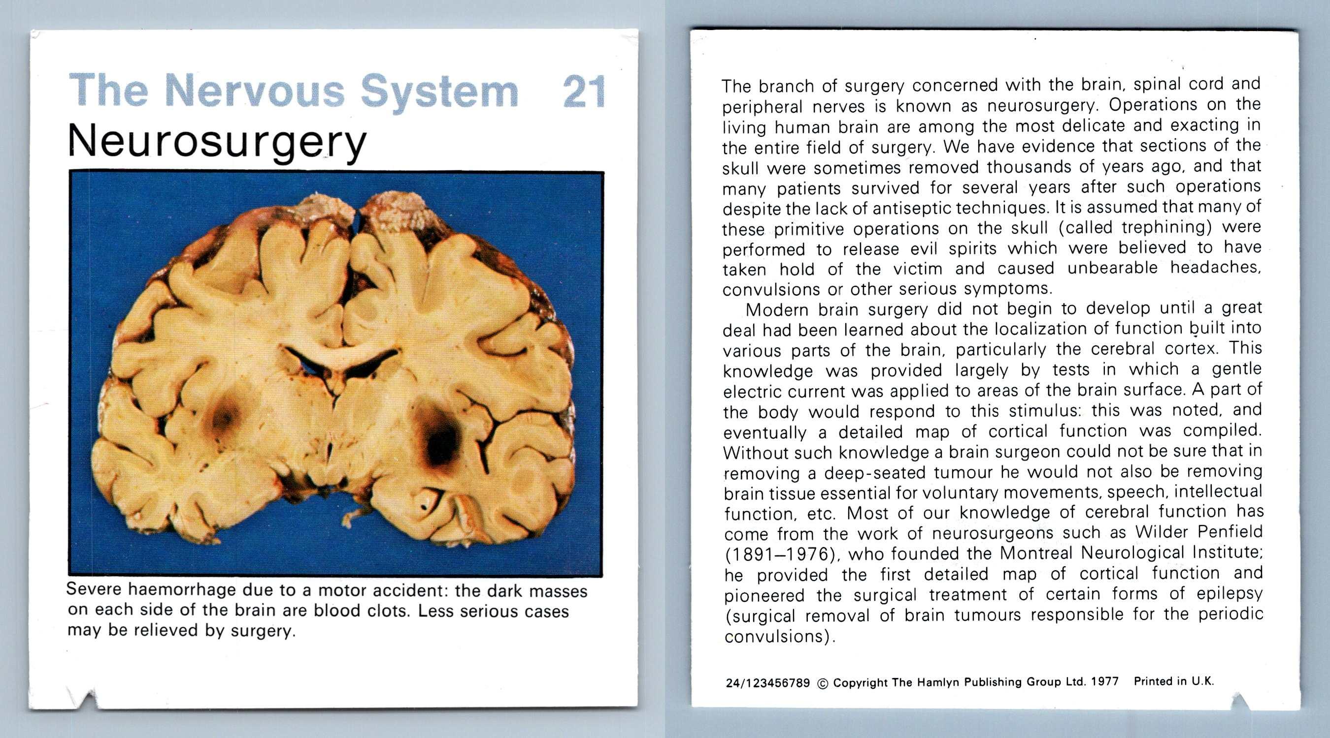 Neurosurgery #21 Nervous System Home Medical Guide 1975-8 Hamlyn Card ...