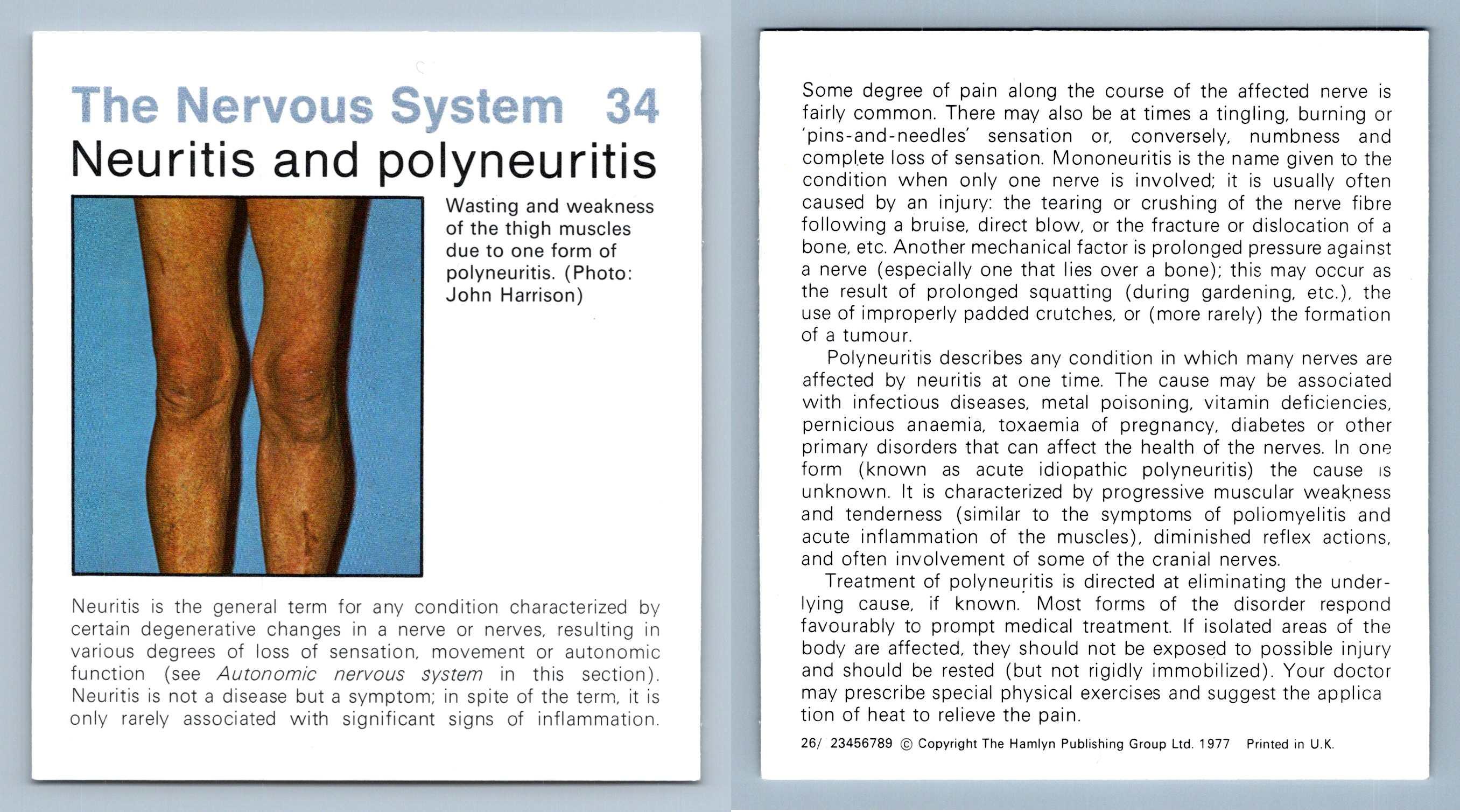 Neuritis & Polyneuritis #34 Nervous System Home Medical Guide 1975-8 H ...