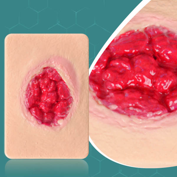 Card-sized Granulation Wound Simulation Models – MedEduQuest