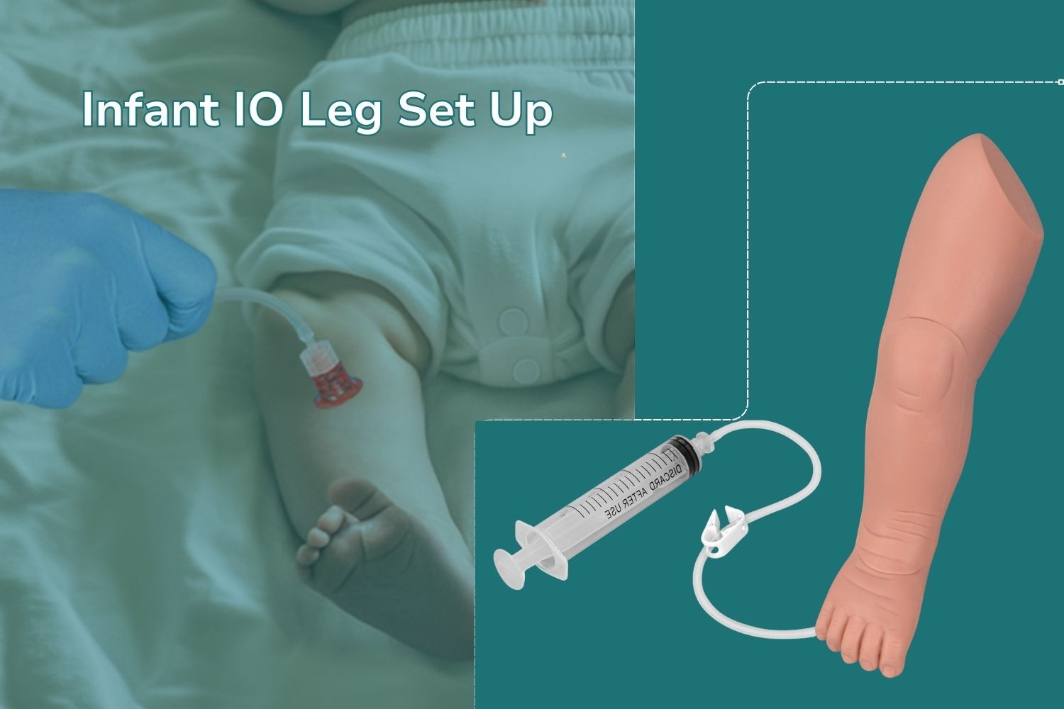 Guidelines For Venipuncture Site Selection – MedEduQuest