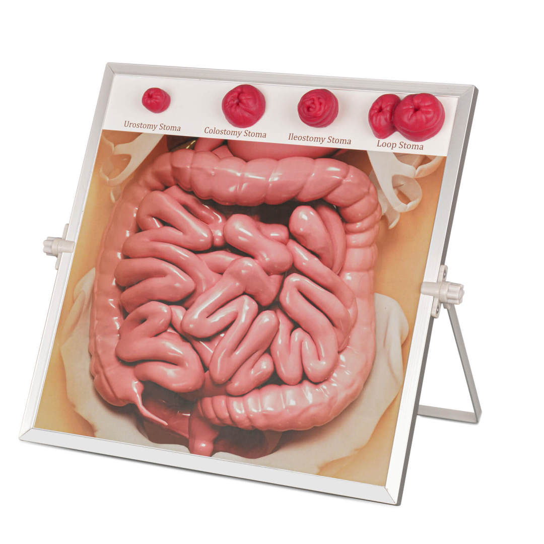 Ostomy Care Training Models – MedEduQuest