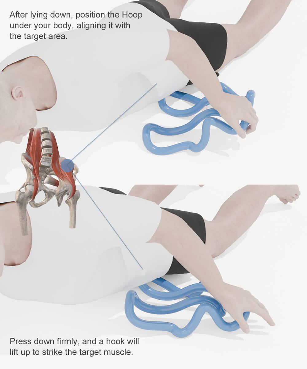 How to Release The Iliacus Trigger Point to Relieve Lower Back Pain at ...