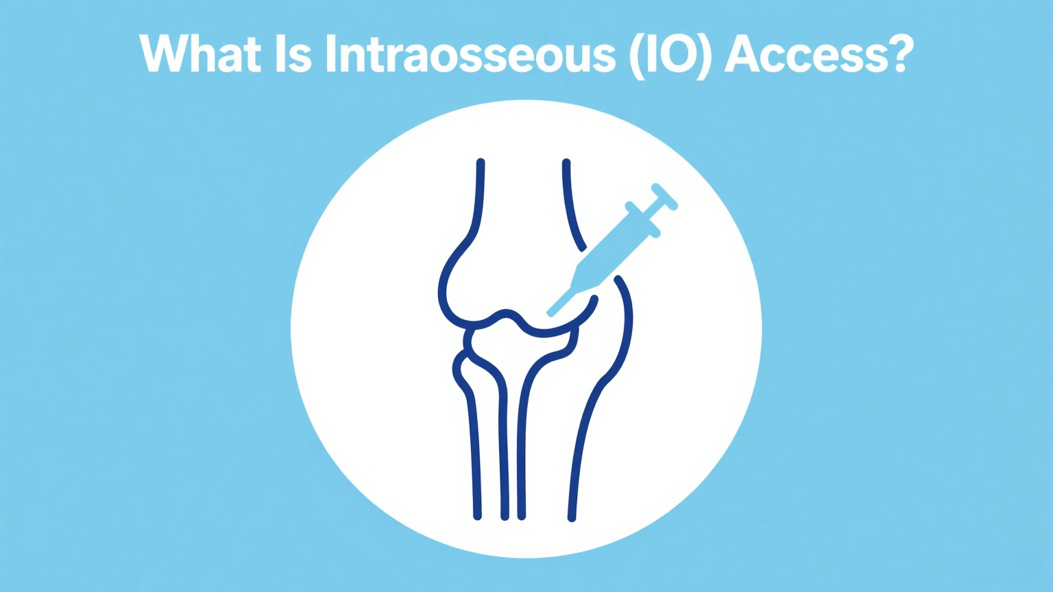 Intraosseous (IO) Access: Definition, Uses, and Steps Explained – SimCoach