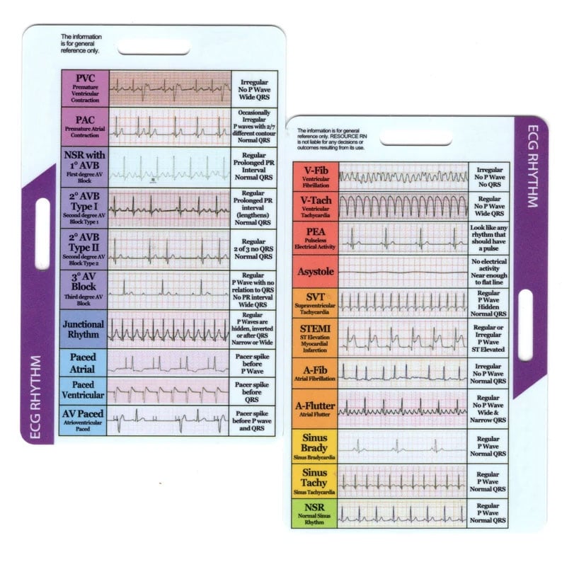 ECG/EKG Rhythm Pocket Card – tihuchun.com