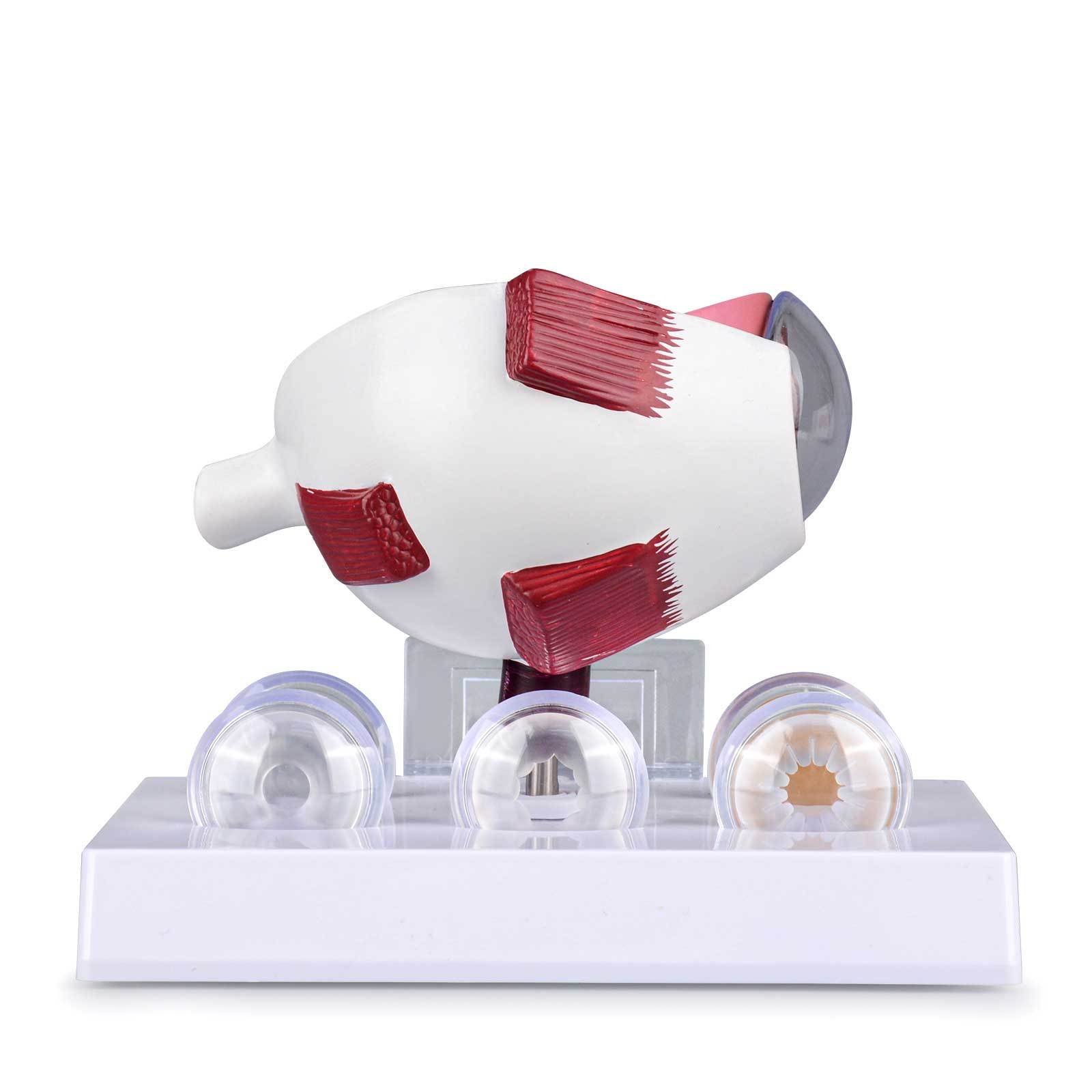 Enlarged Human Cataract Eye Anatomy Model for Ophthalmology Education ...