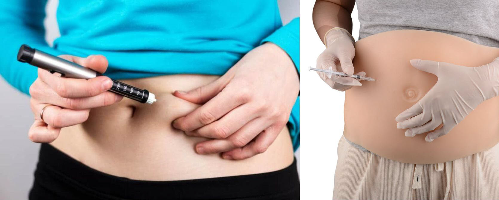 Subcutaneous Injection Mastering Subcutaneous Injections: A Subcutaneous Injection Mastering Subcutaneous Injections: A